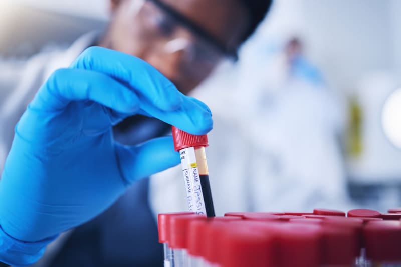 What Blood Tests Are Needed for Canada Immigration Today