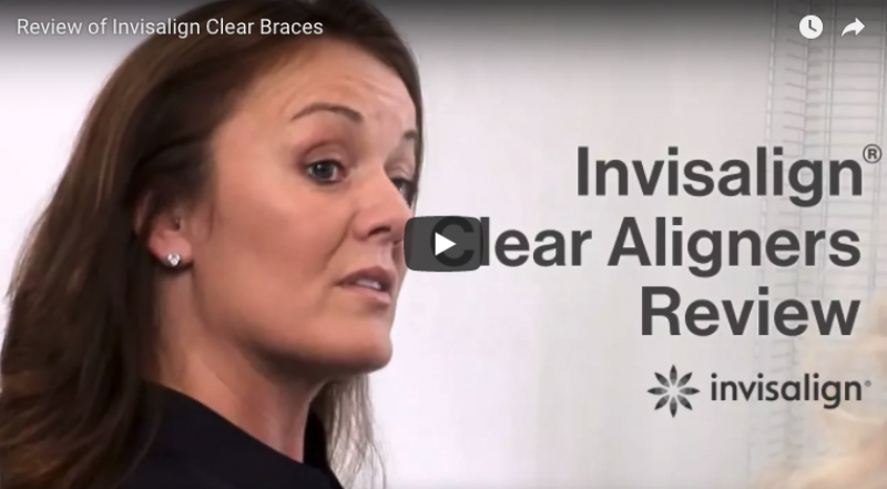Invisalign Review Series: Part 3 | Straight Smile Centres | BC Dentists